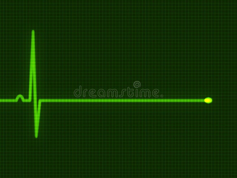 Cardiograma stock de ilustración. Ilustración de pulso - 19619906