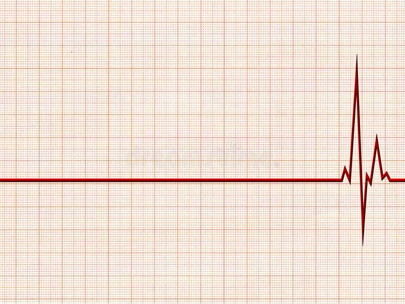 Electrocardiograma stock de ilustración. Ilustración de vida - 8907861