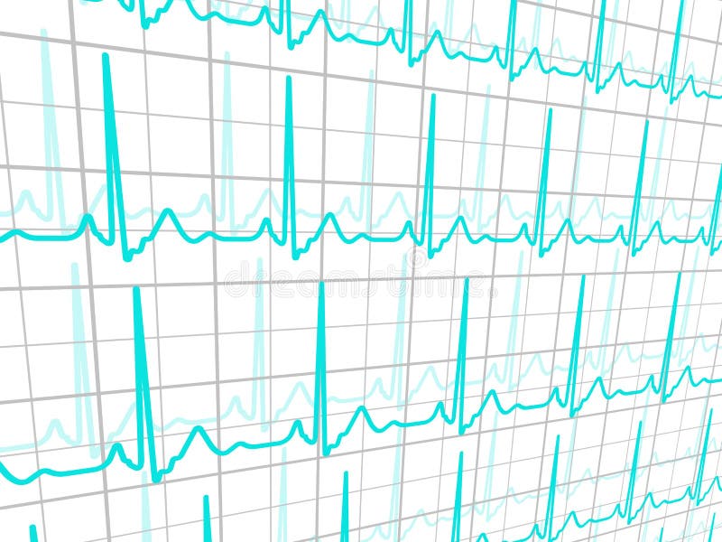 Cardiograma Del Corazón. EPS 8 Ilustración del Vector - Ilustración de ...