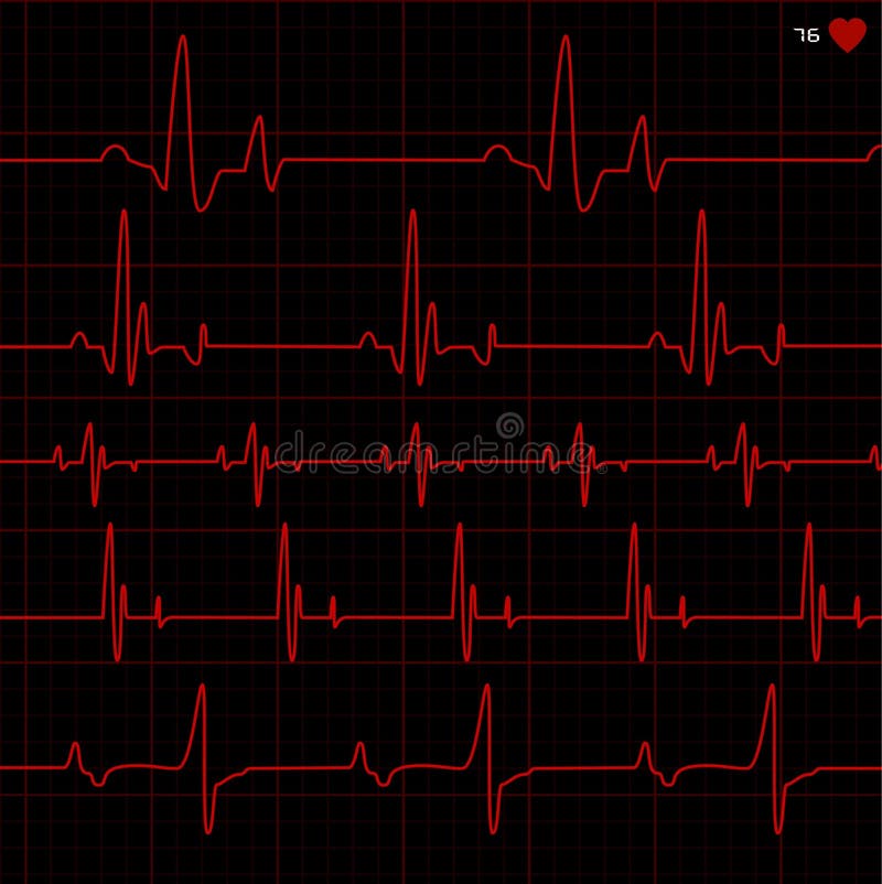 Cardiograma del vector ilustración del vector. Ilustración de muestra ...