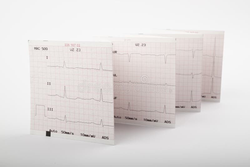 Cardiogramme image stock. Image du configuration, papier - 19656419