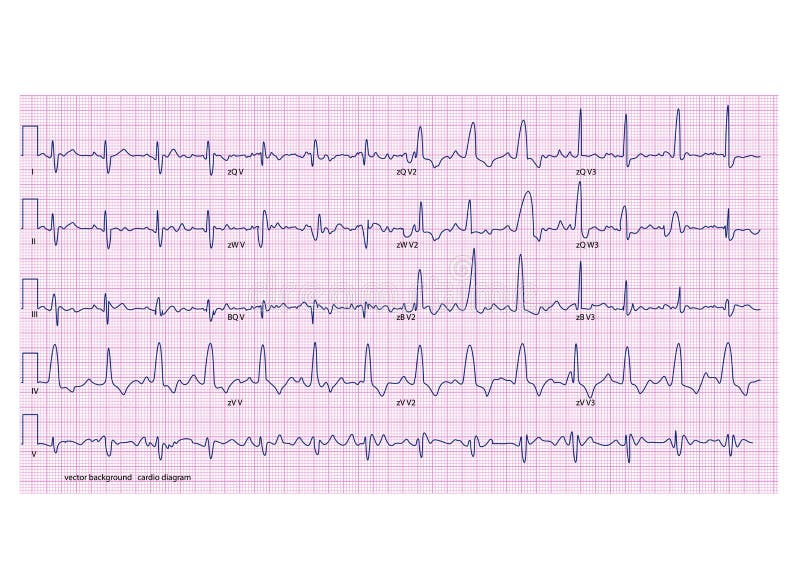 Cardiogramme illustration de vecteur. Illustration du ligne - 32271331