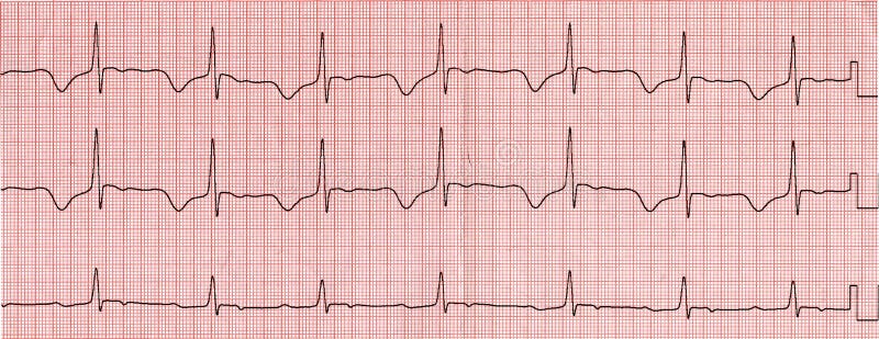 Cardiogramme photo stock. Image du expérience, urgence - 4528150