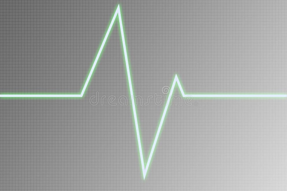 Cardiogramwelle - Funkwelle Stock Abbildung - Illustration von grün ...