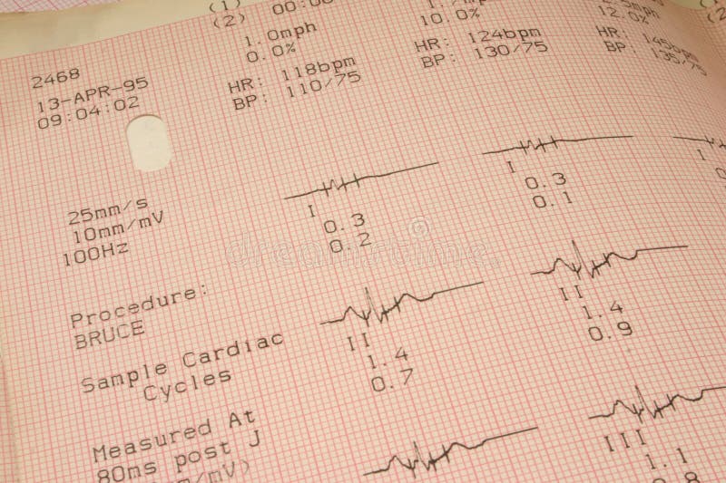 Cardiological test results stock photo. Image of analyze - 410988