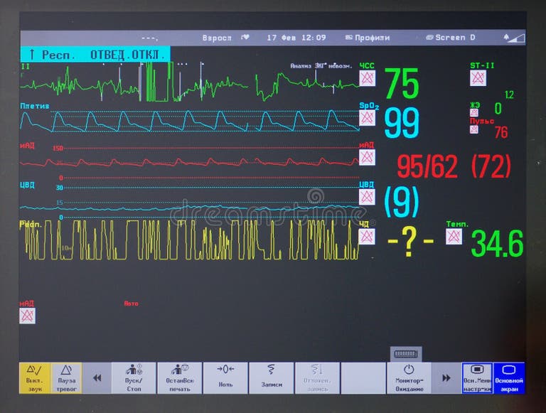 Cardiomonitor imagen de archivo. Imagen de curvas, central - 38149097