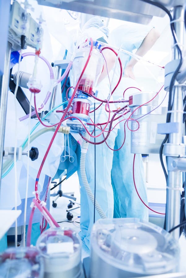 Cardiopulmonary Bypass in Cardiac Surgery Stock Photo - Image of flow ...