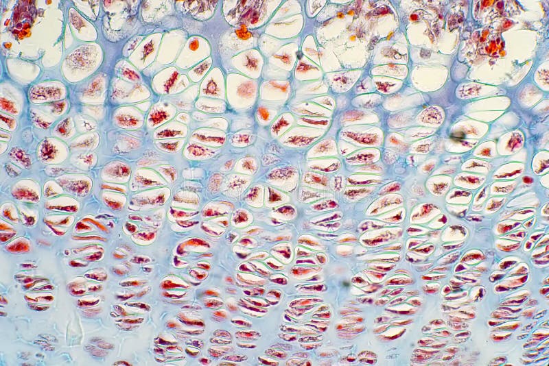 Cartilage is a Resilient and Smooth Elastic Tissue for Pathology ...