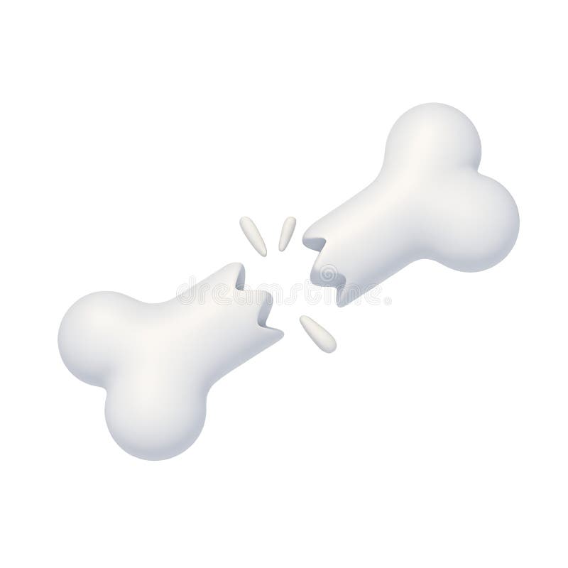 Cartoon Bone Broken stock photo. Illustration of pieces - 375672732
