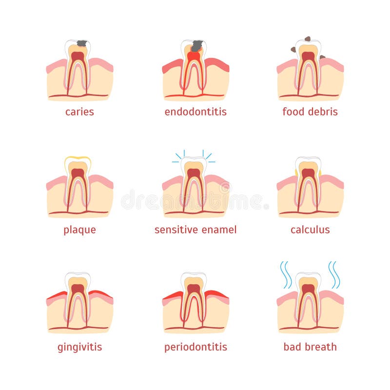 Cartoon Tooth Sensitivity Problems Stock Illustrations – 19 Cartoon ...