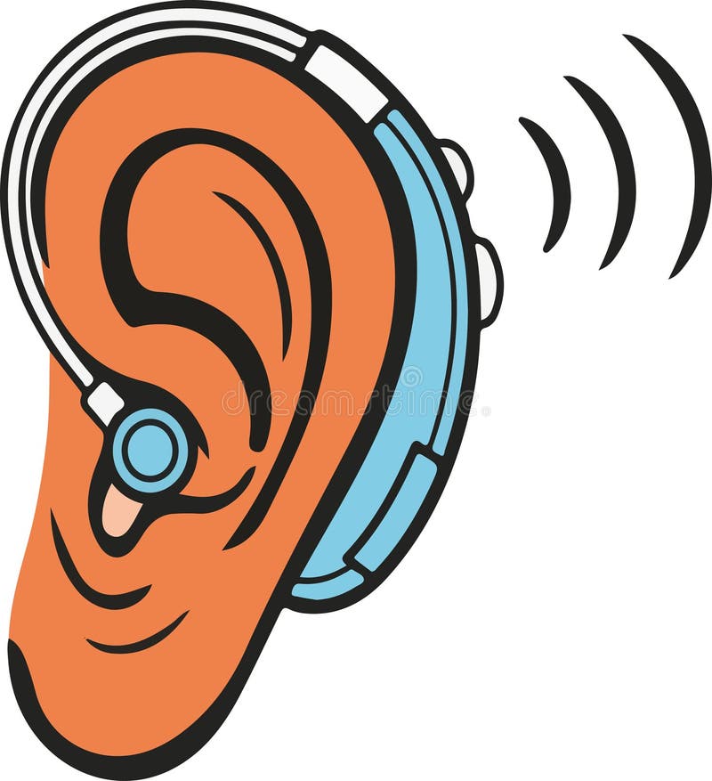 A Cartoon Ear with a Hearing Aid on it Stock Illustration ...