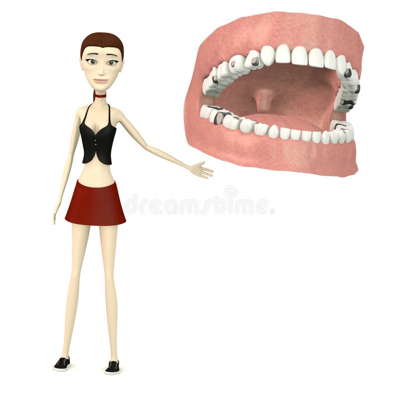Cartoon Girl with Teeth and Fillings Stock Illustration - Illustration ...