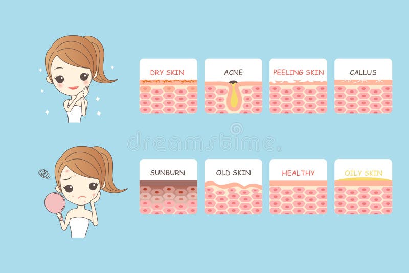 Cartoon girls face problem stock vector. Illustration of acne - 78077061