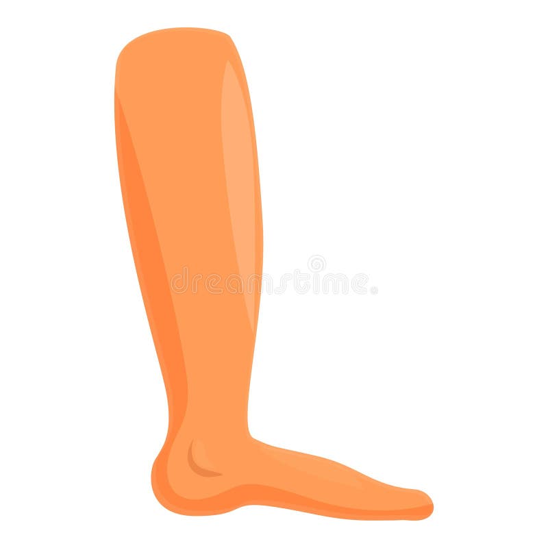 Cartoon Human Leg Showing Flat Foot Pathology Stock Vector ...