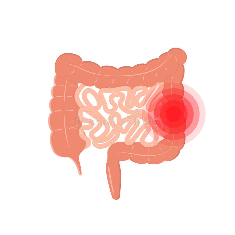 Cartoon Intestinal Tract Like Irritable Bowel Syndrome Icon Stock ... Cartoon Intestinal Tract Like Irritable Bowel Syndrome Icon Stock ...
