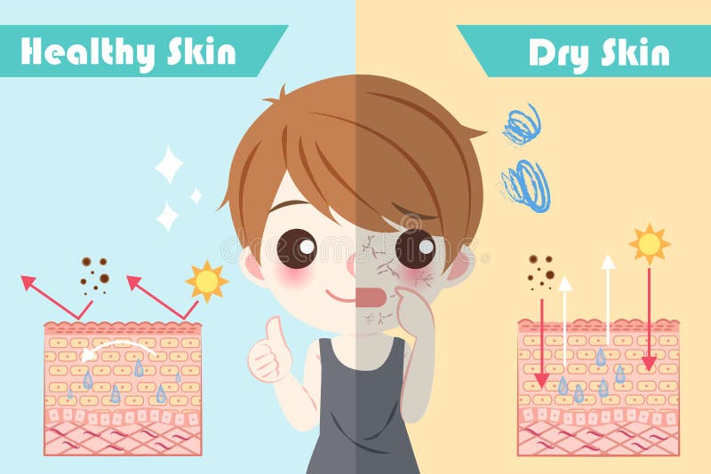 Man Acne Cartoon Stock Illustrations – 310 Man Acne Cartoon Stock ...