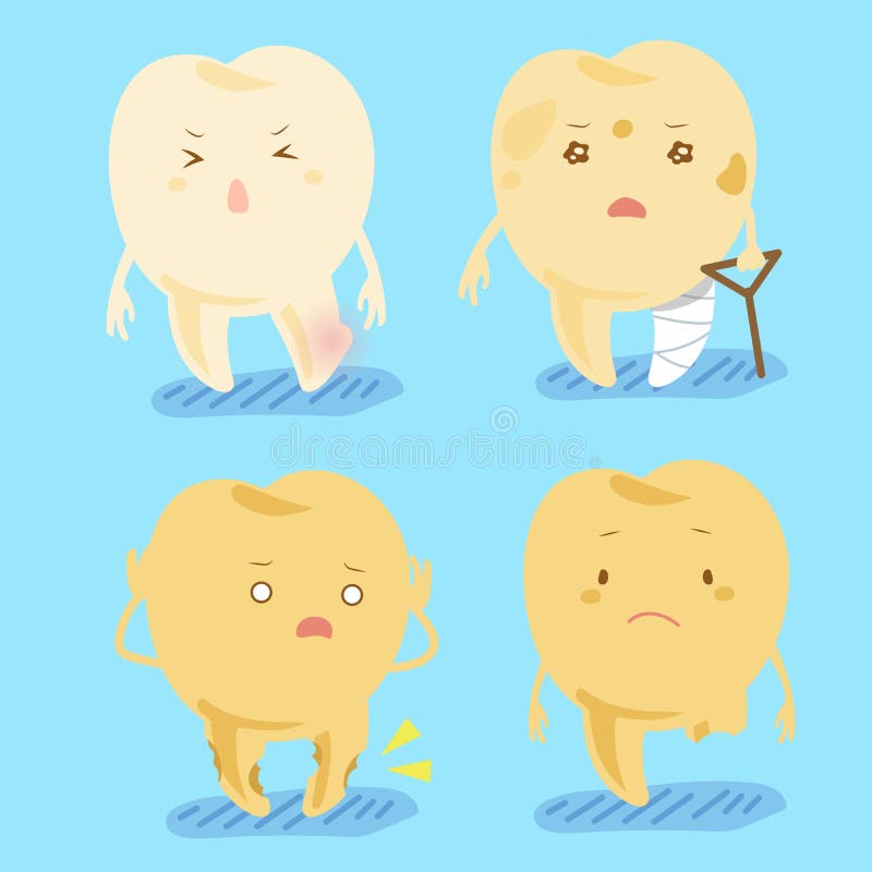 Cartoon tooth decay stock vector. Illustration of cavity - 85389764