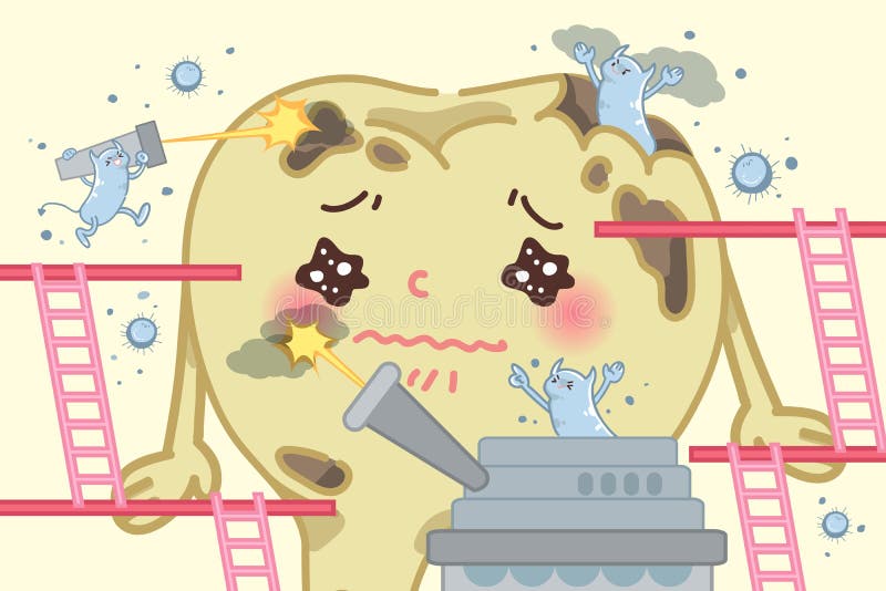 Cartoon tooth decay stock vector. Illustration of dental - 96062073