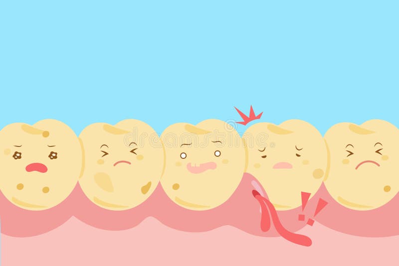 Tooth Decay With Health Problem Stock Vector - Illustration of cartoon ...