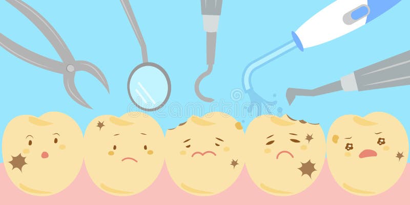 Cartoon Tooth Decay with Tools Stock Vector - Illustration of dentist ...