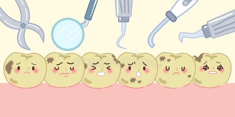 Cartoon Tooth Decay with Tools Stock Vector - Illustration of cavity ...