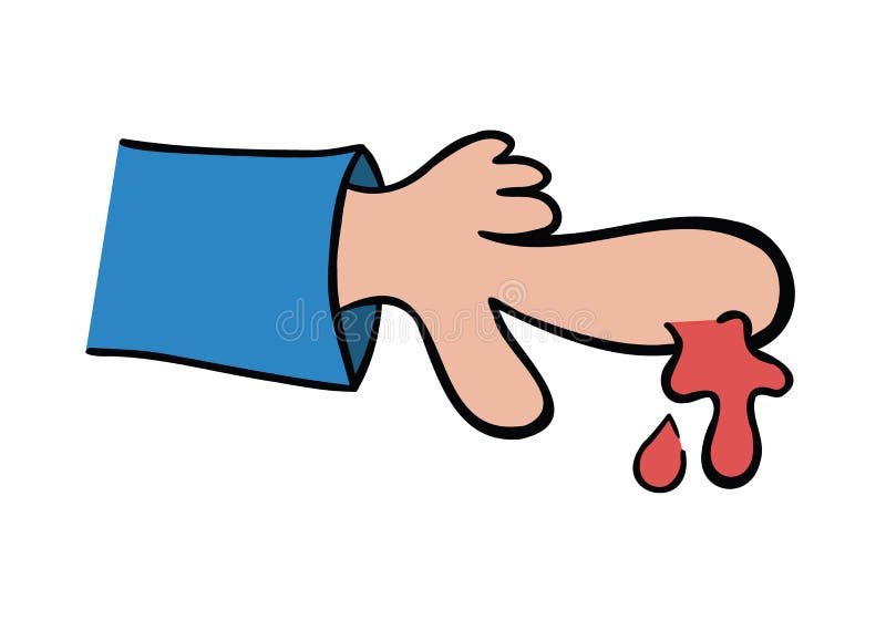 Bleeding finger stock illustration. Illustration of dangerous - 2490032