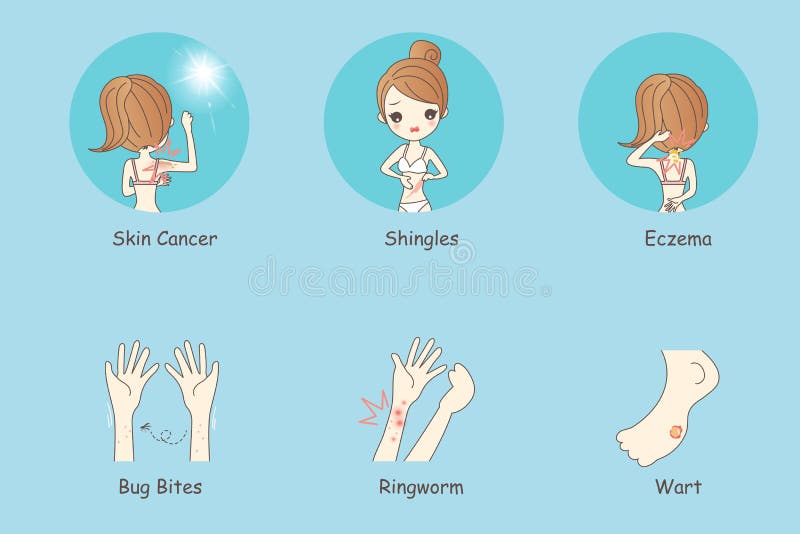 Cartoon Woman Has Skin Problem Stock Vector - Illustration of barefoot ...