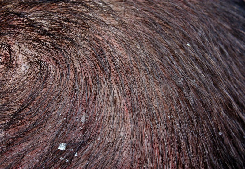 7,102 Caspa Fotos - Libres de Derechos y Gratuitas de Dreamstime