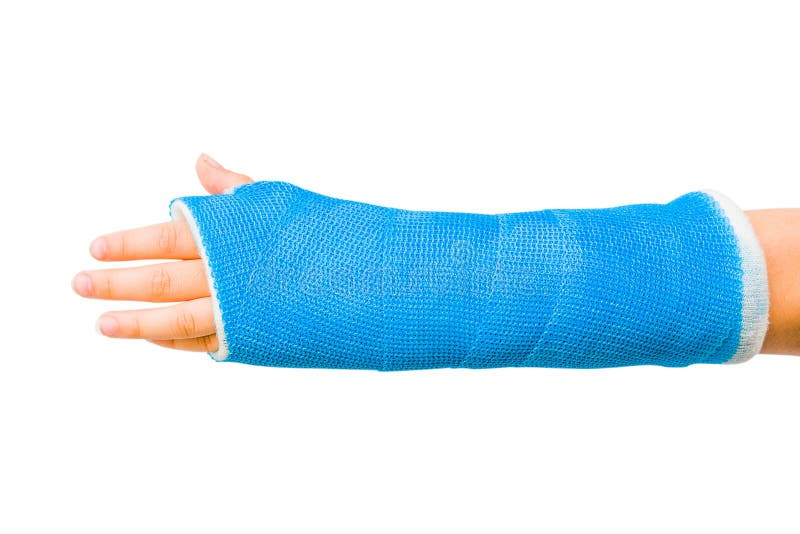 481 Arm Blue Cast Stock Photos - Free & Royalty-Free Stock Photos from ...