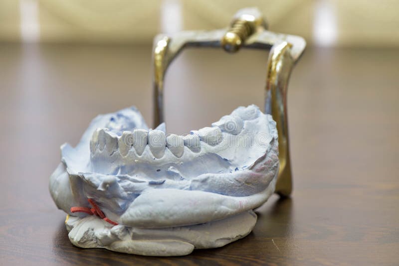 Cast of teeth stock photo. Image of dentist, medicine - 90551904