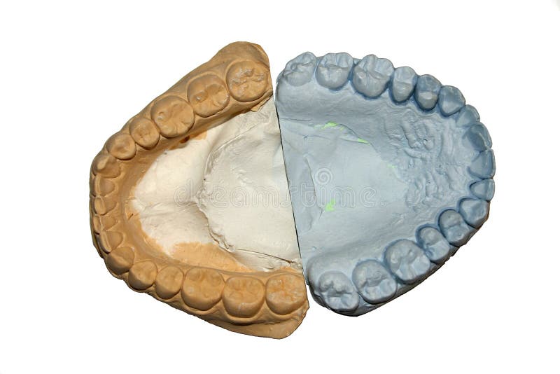 Cast Teeth Model Picture. Image: 347411