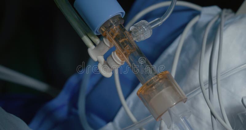 The Cat Lies on the Operating Table Connected To Monitors and a Machine ...