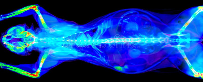 Mrt Organs Stock Photos - Free & Royalty-Free Stock Photos from Dreamstime