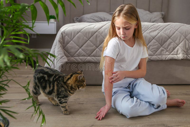 The Cat Scratched the Child`s Hand Stock Image - Image of child ...