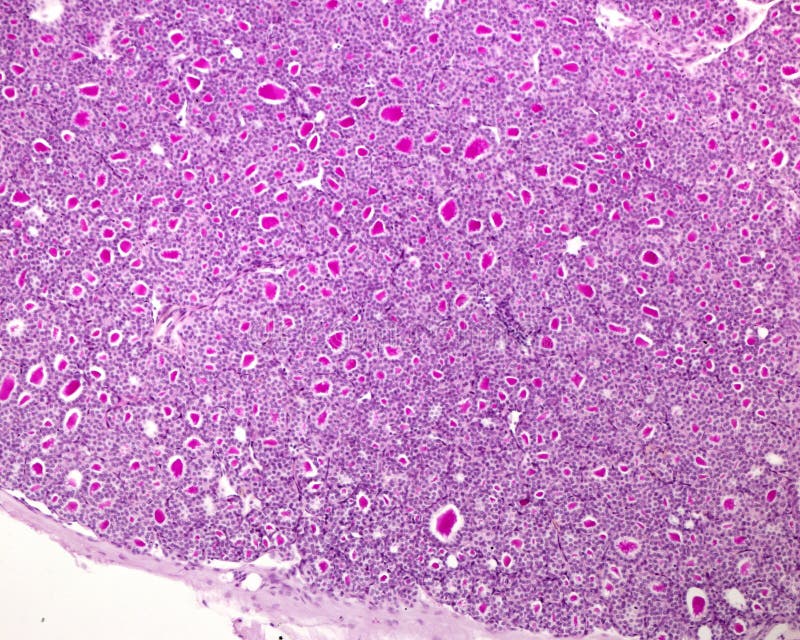 Cat Thyroid Gland. Periodic Acidâ€“Schiff PAS Method Stock Photo ...