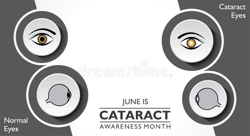 Cataract Awareness Month Observed in June, it is a Dense, Cloudy Area ...