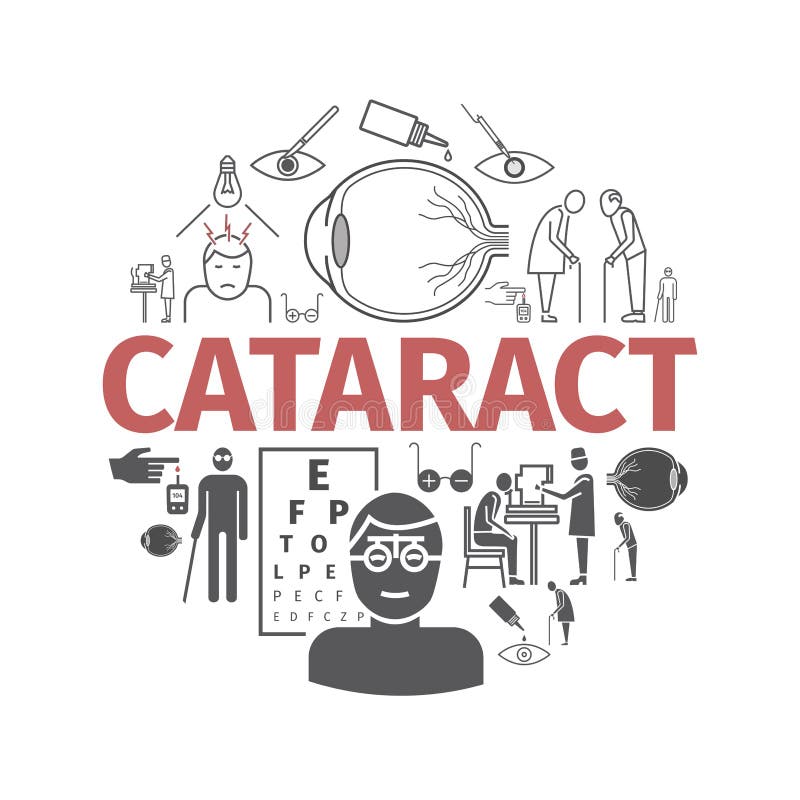 Cataract. Symptoms Banner. Vector Signs for Web Graphics. Stock Vector ...