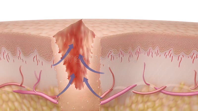 Blood Hospital Floor Stock Illustrations – 75 Blood Hospital Floor ...