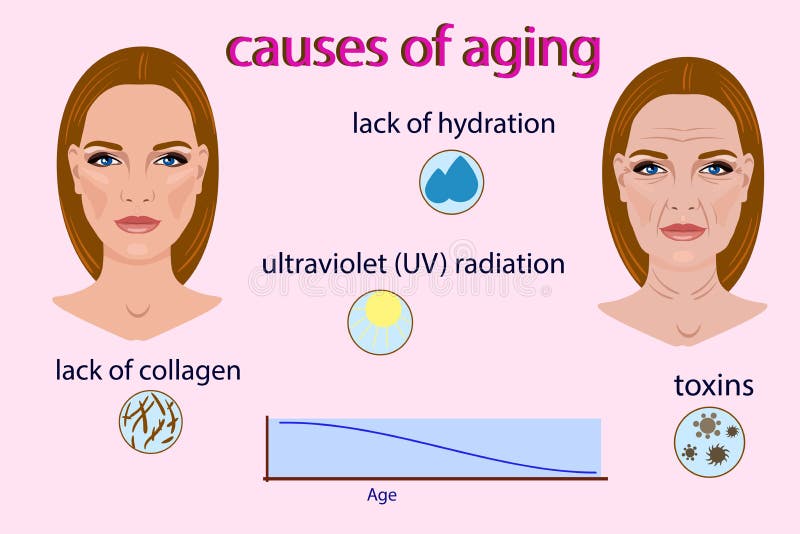 Skin Aging, Collagen in Young and Old Skin Stock Vector - Illustration ...
