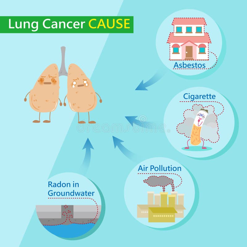 Causes de cancer de poumon illustration de vecteur. Illustration du ...