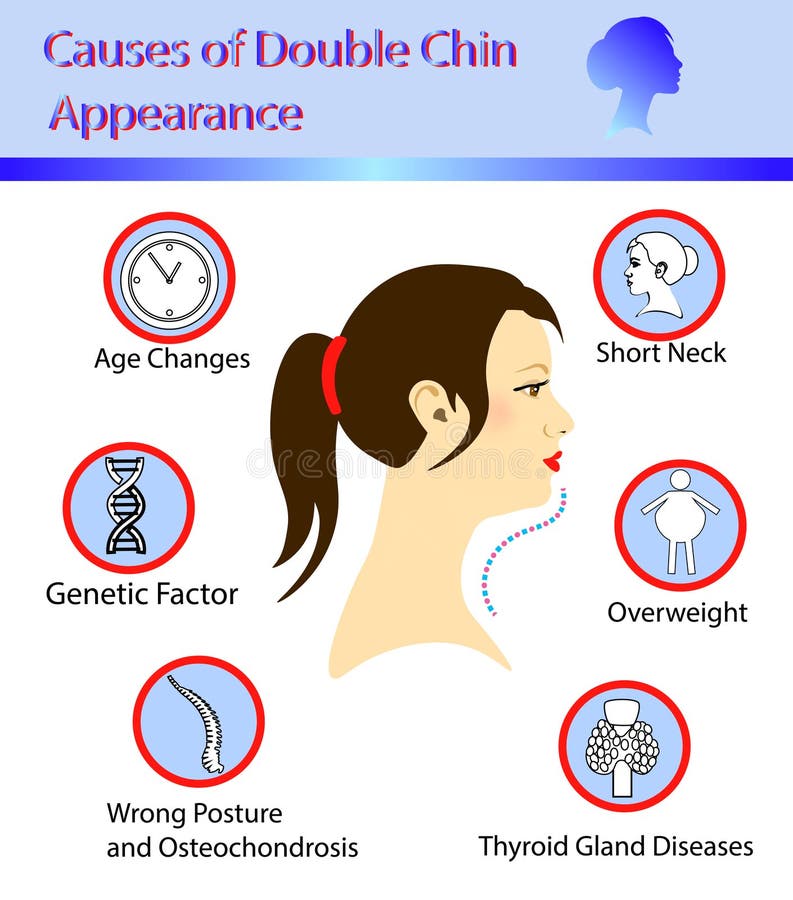 Double Chin Stock Illustrations – 305 Double Chin Stock Illustrations ...