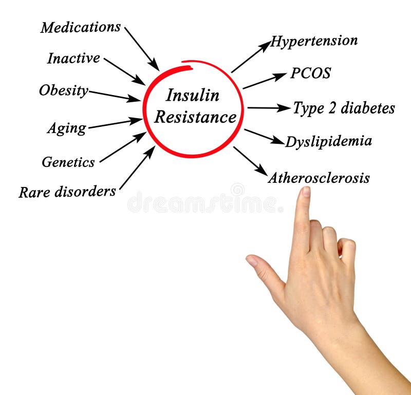 Rare Type Diabetes Stock Photos - Free & Royalty-Free Stock Photos from ...