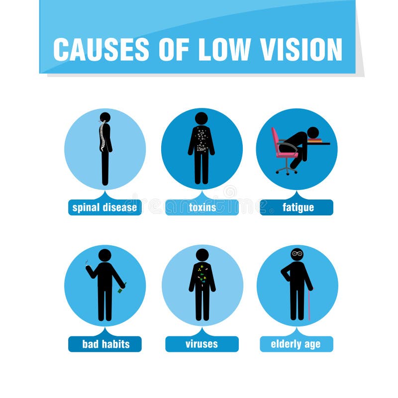 Causes of low vision. stock vector. Illustration of sign - 274761000