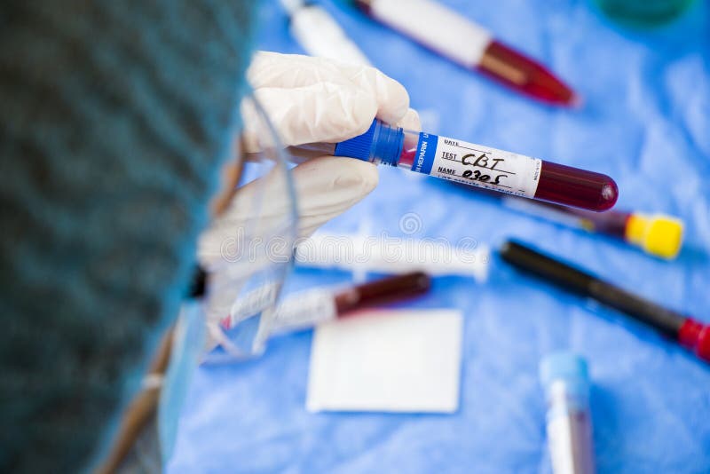CBC Blood Test Tube Sample in Doctors Hand Stock Photo - Image of ...