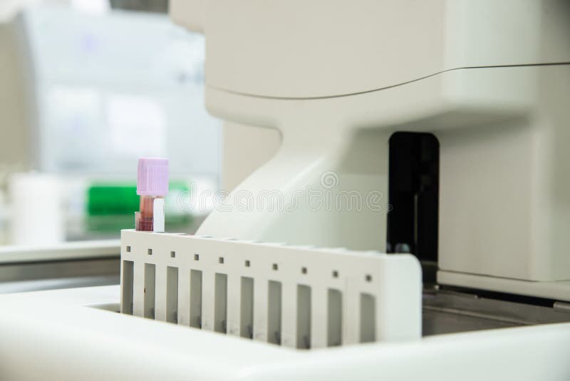 CBC in laboratory stock image. Image of medical, experiment - 139594301