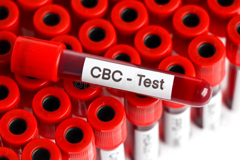 CBC Test for Abnormalities in Red Blood Cells, Blood Samples To Be ...
