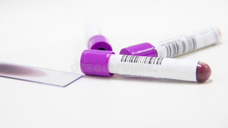 CBC test stock photo. Image of label, bottle, doctor - 95061278