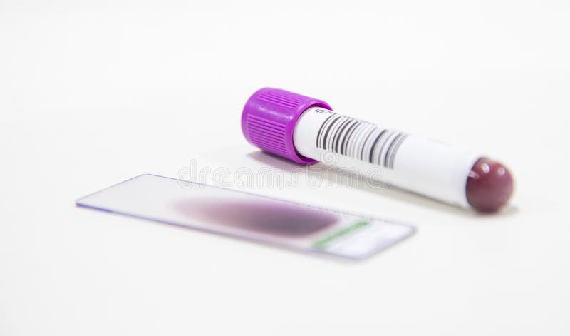 CBC test stock photo. Image of healthcare, hospital, hand - 95061512