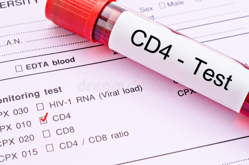 CD4 cell testing. stock image. Image of biology, complete - 75316797