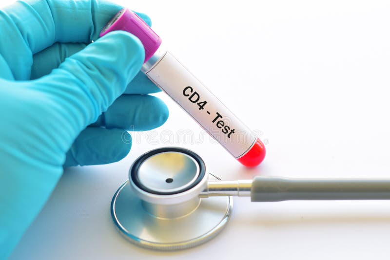 CD4 test stock foto. Image of experiment, chemisch, steekproef - 102498874